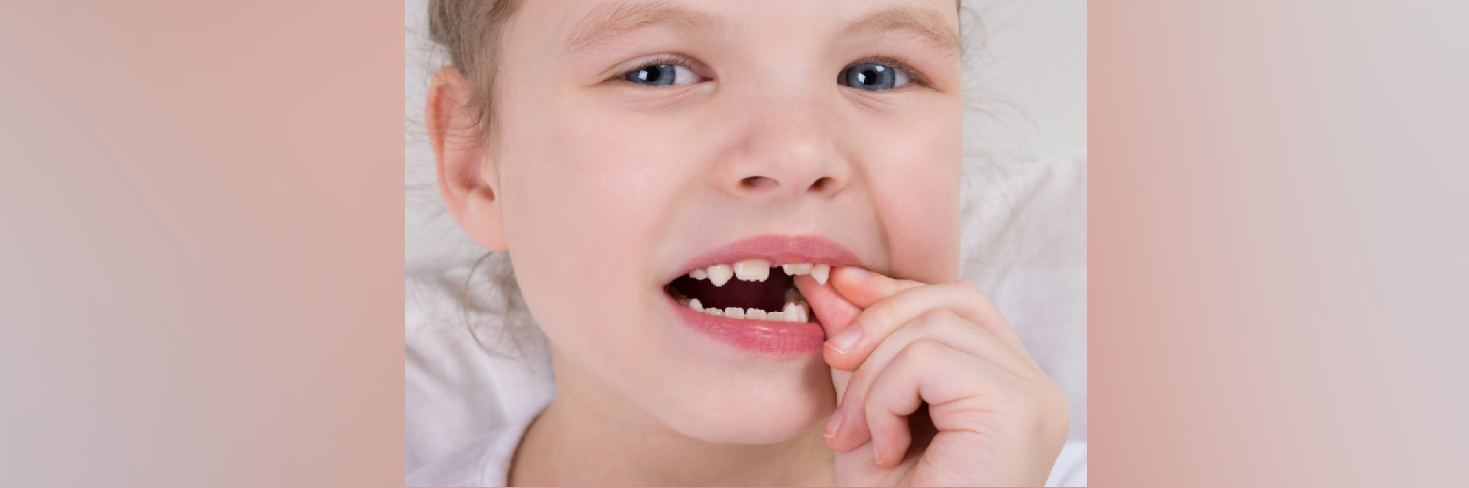 What To Expect After A Baby Tooth Extraction - Kalyani Dental Lounge