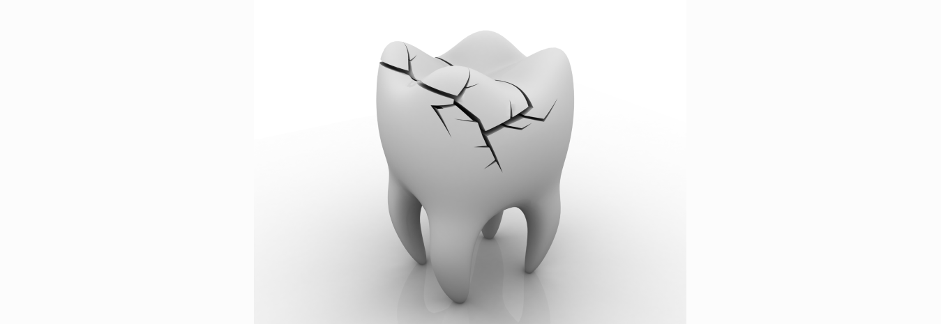 Need to Know: Tooth Infection - Kalyani Dental Lounge